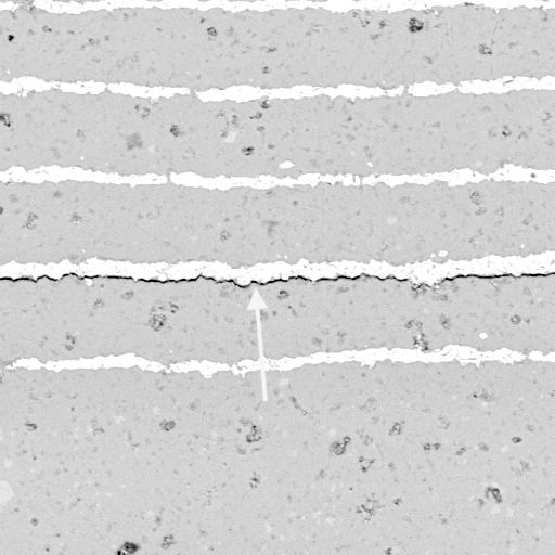 MLCC Knit Line Related Failures - SEM Lab Inc.